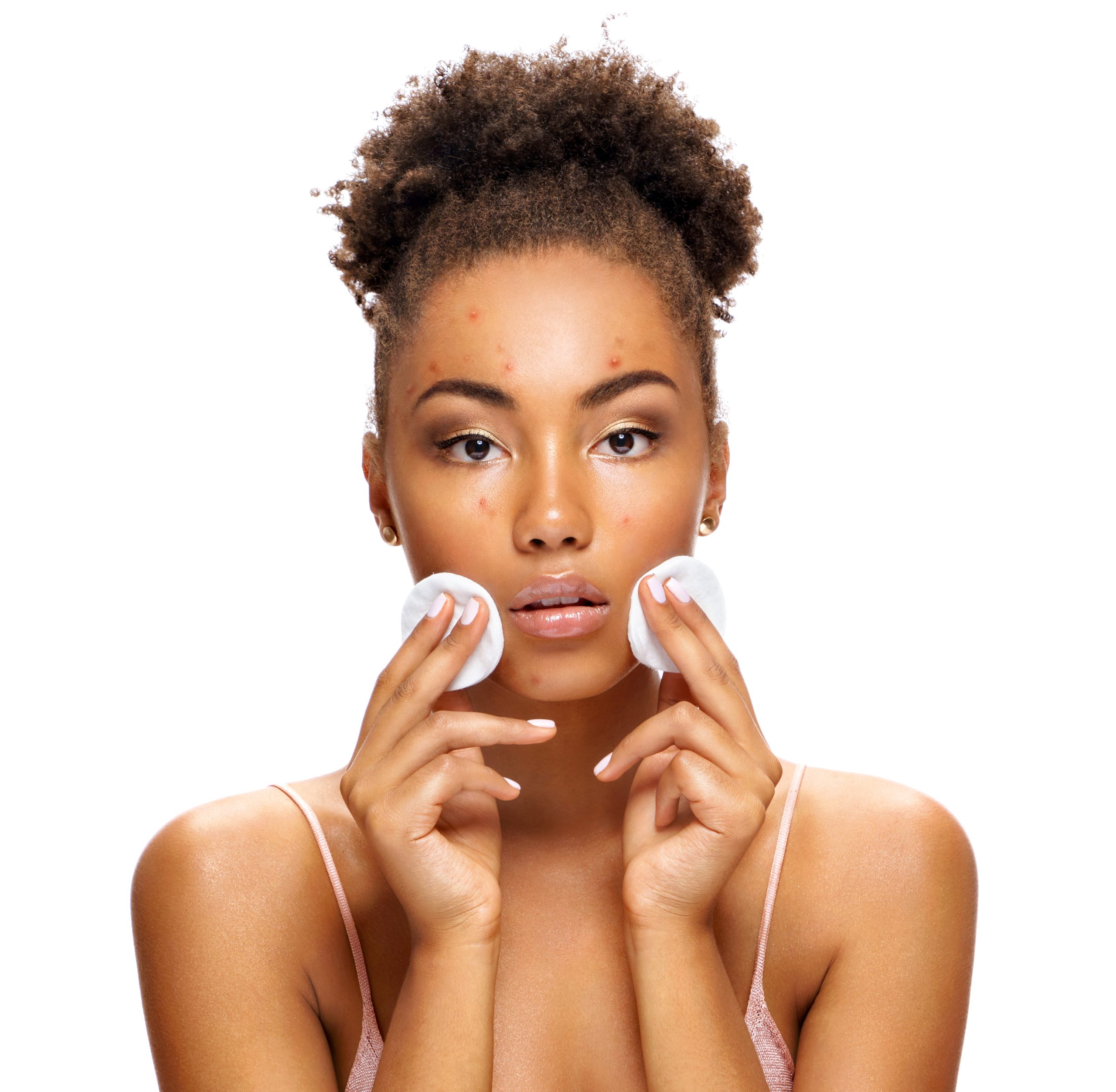 Combat Acne with These Tips and Hacks - DefenderNetwork.com